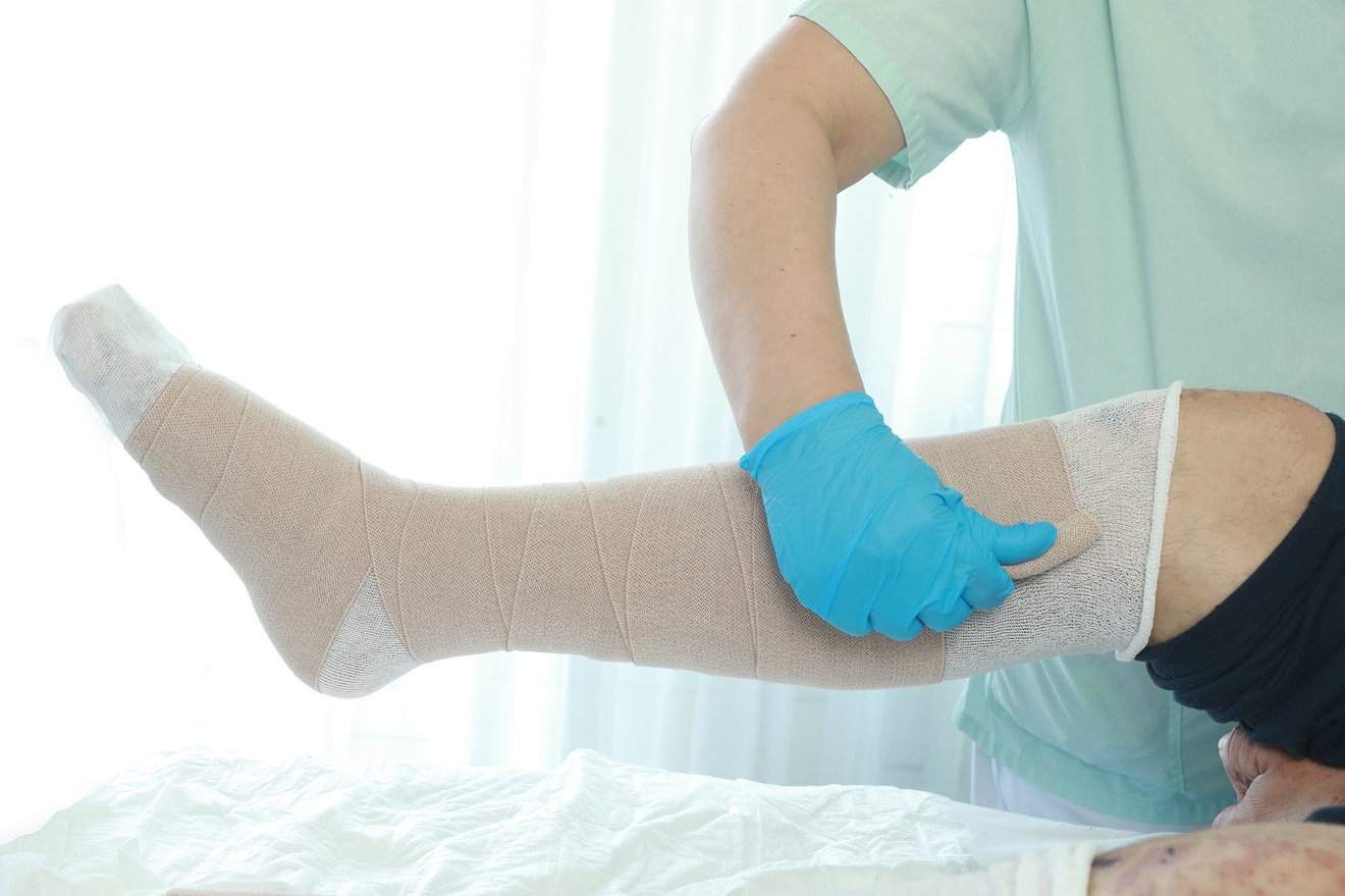 Ulcus cruris | Dermatologie, Phlebologie, Allergologie | Klinikum Stuttgart